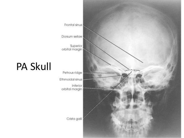 All projections Anatomy