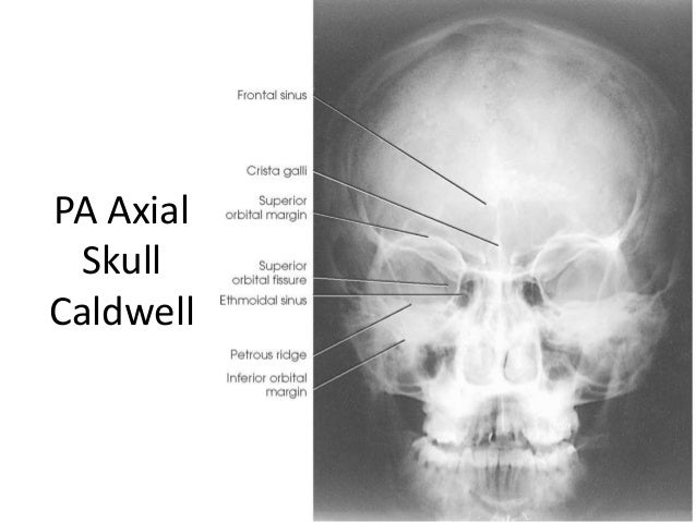 All projections Anatomy