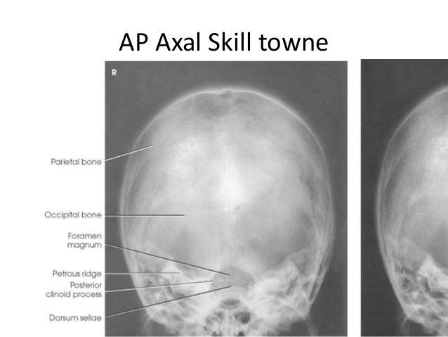 All projections Anatomy
