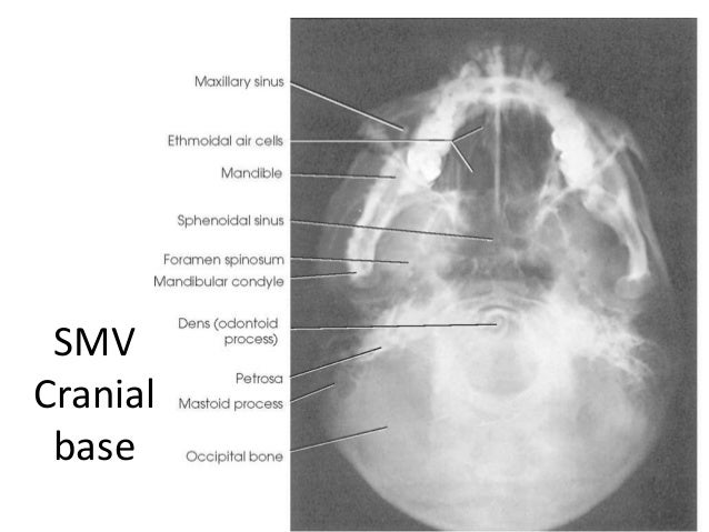 All projections Anatomy