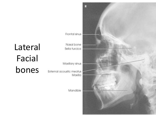 All projections Anatomy