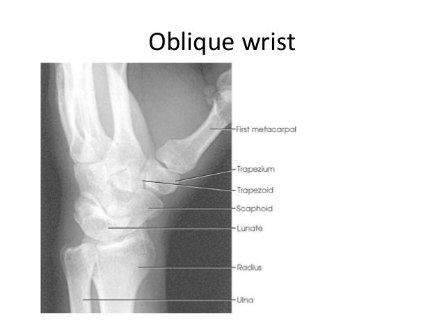 All projections Anatomy