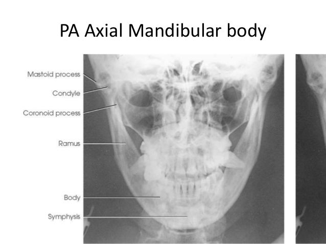 All projections Anatomy