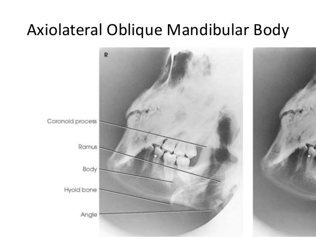 All projections Anatomy