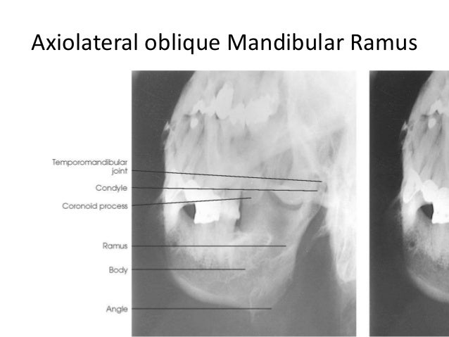 All projections Anatomy