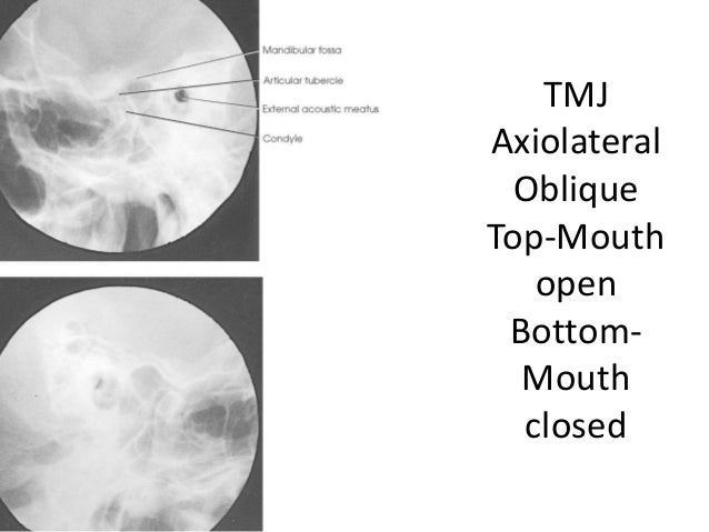 All projections Anatomy