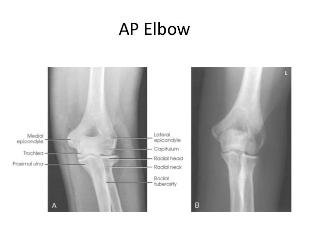 All projections Anatomy