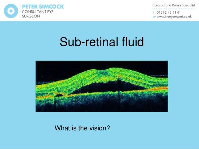 All you need to know about amd and the oct but were afraid to ask