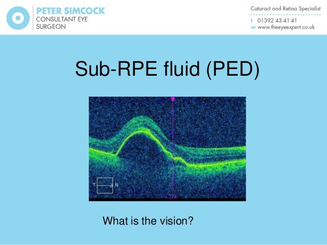All you need to know about amd and the oct but were afraid to ask