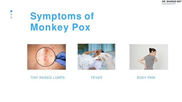 All You Need To Know About Money Pox Virus | Dr. Sharad ENT | PPT