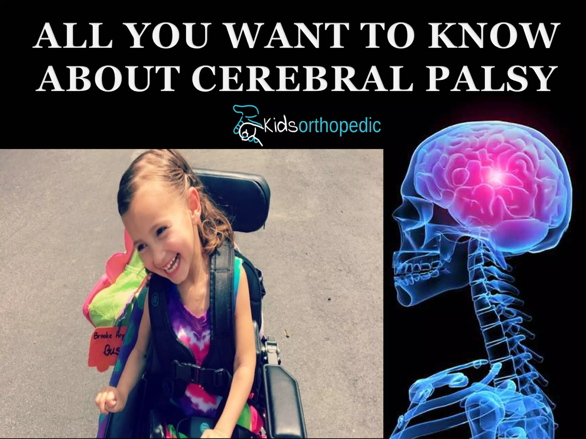 All you want to know about cerebral palsy | PPT