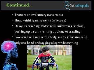 All you want to know about cerebral palsy | PPT