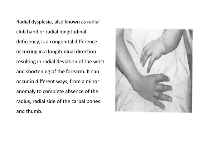All you want to know about radial dysplasia | PPTX | Death, Injury, or ...
