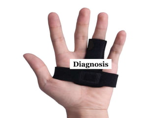 All you want to know about trigger finger by kids orthopedic | PPT