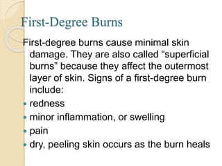 Burns | PPTX