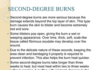 Burns | PPTX