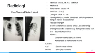 Almadania Hensa Putri-Efusi Pleura Dextra.pptx