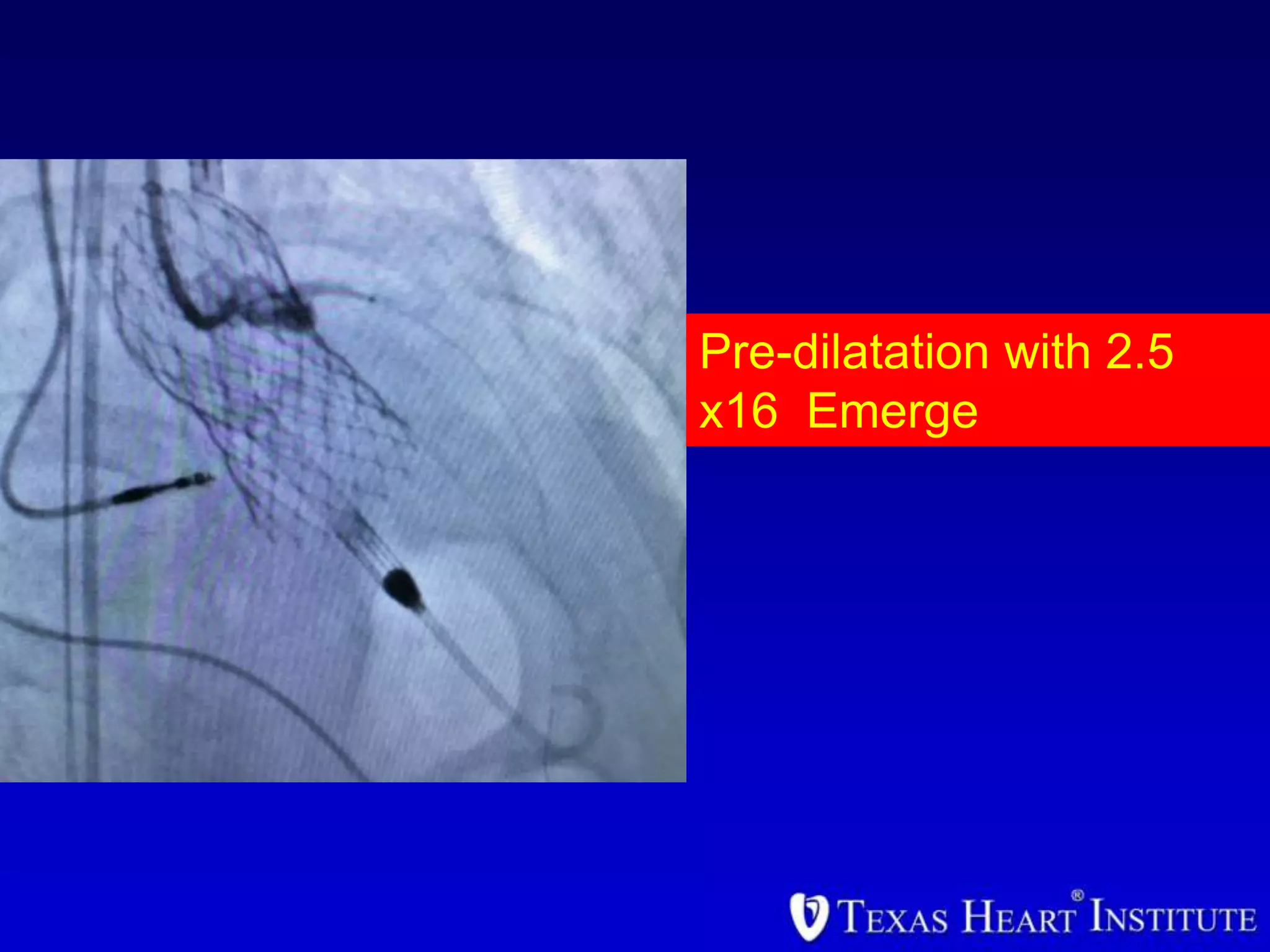 High Risk Left main PCI using Impella in post-TAVR patient | PPTX