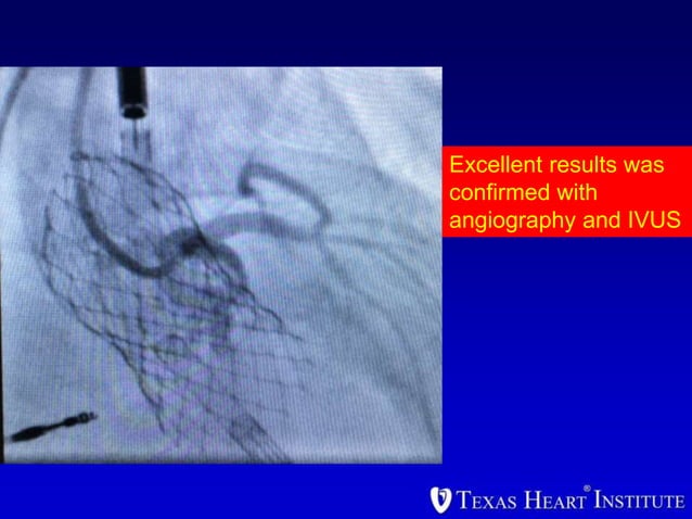 High Risk Left main PCI using Impella in post-TAVR patient | PPTX | Heart and Cardiovascular ...
