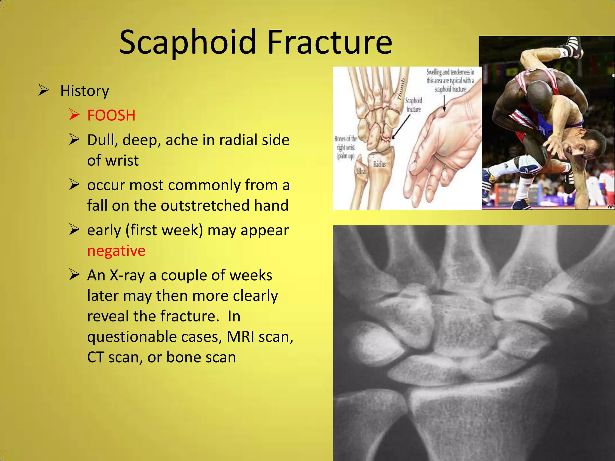 fracture and dislocation ppt . Almas khan. khorfakkhan hospital dubai ...