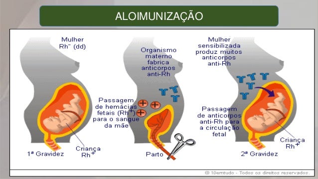 Aloimunização materno –fetal e Assistência de Enfermagem a gestação m…