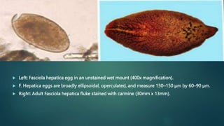 Alok Kumar (Grp 09) Fascioliasis.pptx