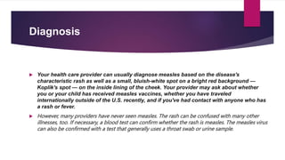 Alok Kumar (Grp 09) Measles.pptx