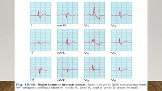 Alok Kumar (Grp 09) Sem 09 Types Of Heart Block.pptx | Heart and ...