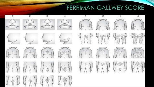 pharmacotherapy of alopecia & hirsutism