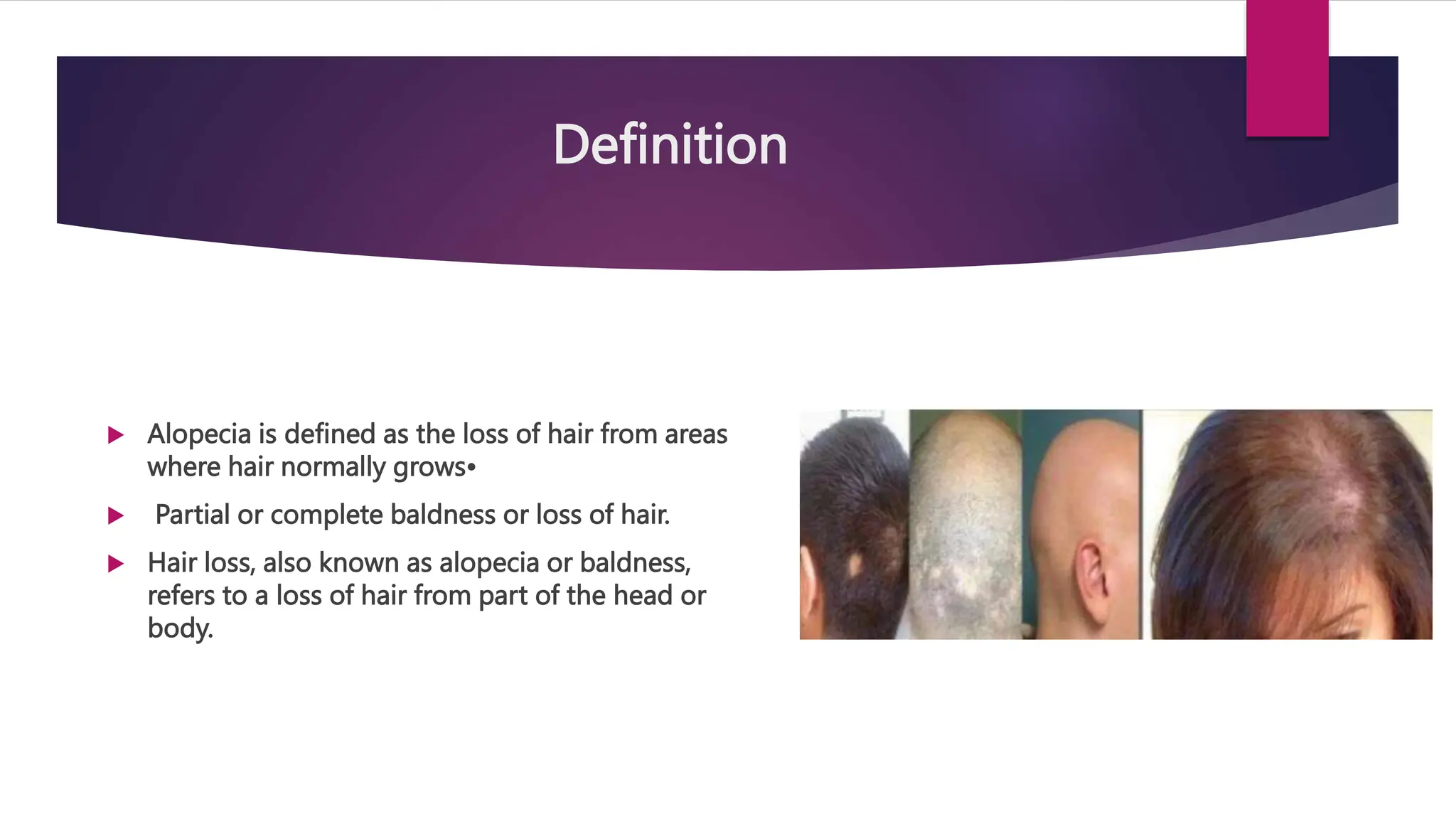 alopecia.pptx