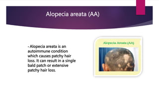 What is Alopecia/Hair loss and treatment.pptx