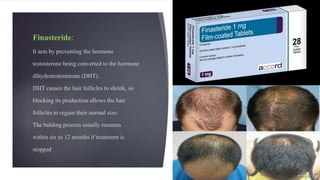Alopecia of hair disorders with medication.pptx