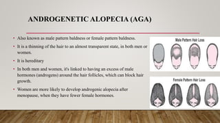 Alopecia & Its evaluation, management, care. | PPTX