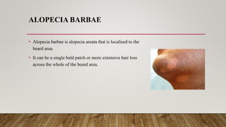 Alopecia & Its evaluation, management, care. | PPTX