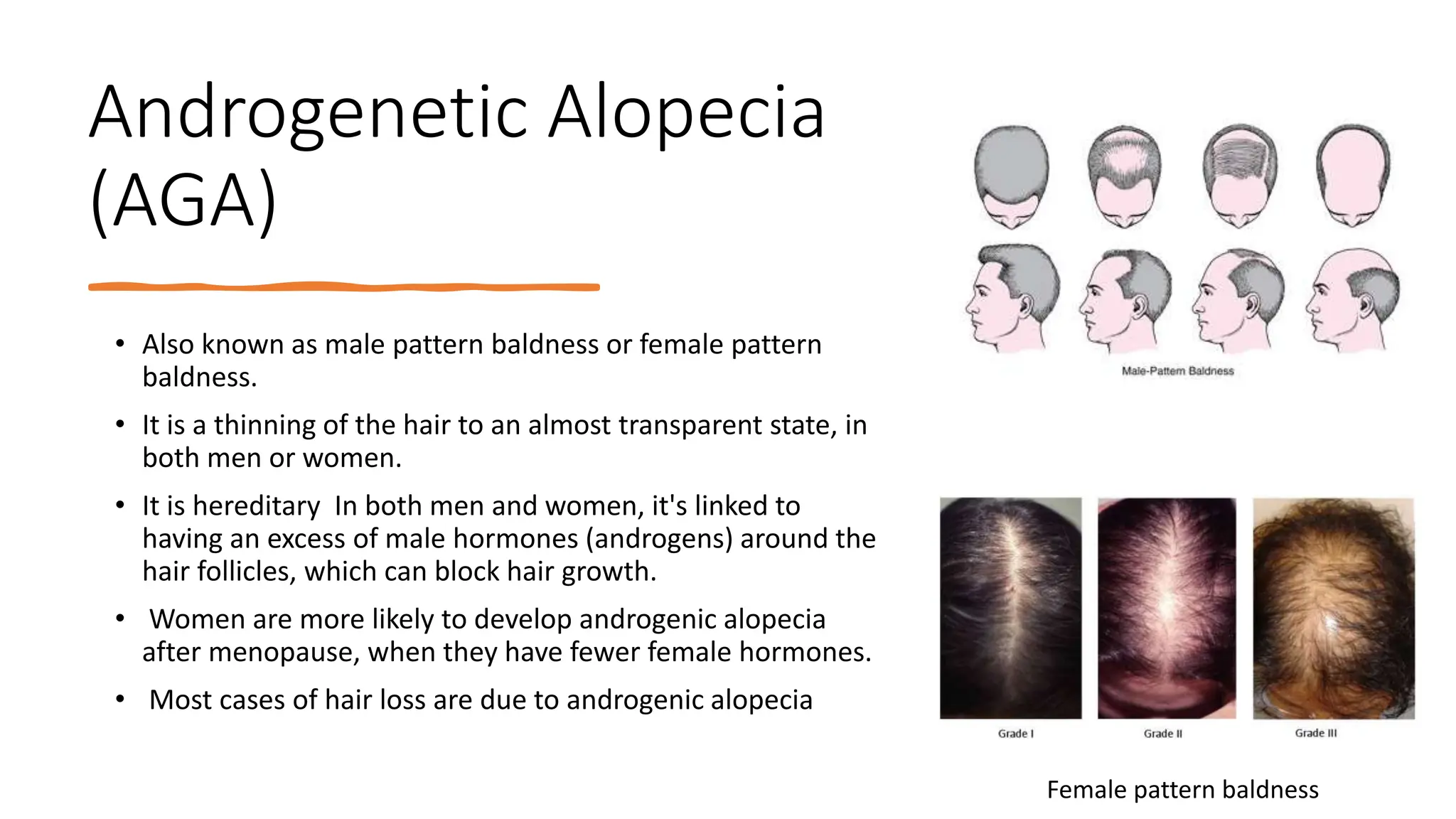 AlopeciaPresentation on Alopecia, dermatology .pptx | Hair Care | Beauty