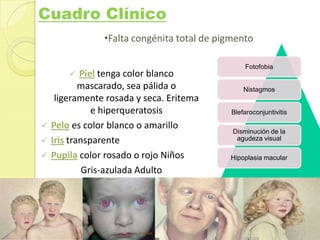 Discromias [Albinismo, Argiria] Enf. Psicosomaticas [Alopecia Areata ...