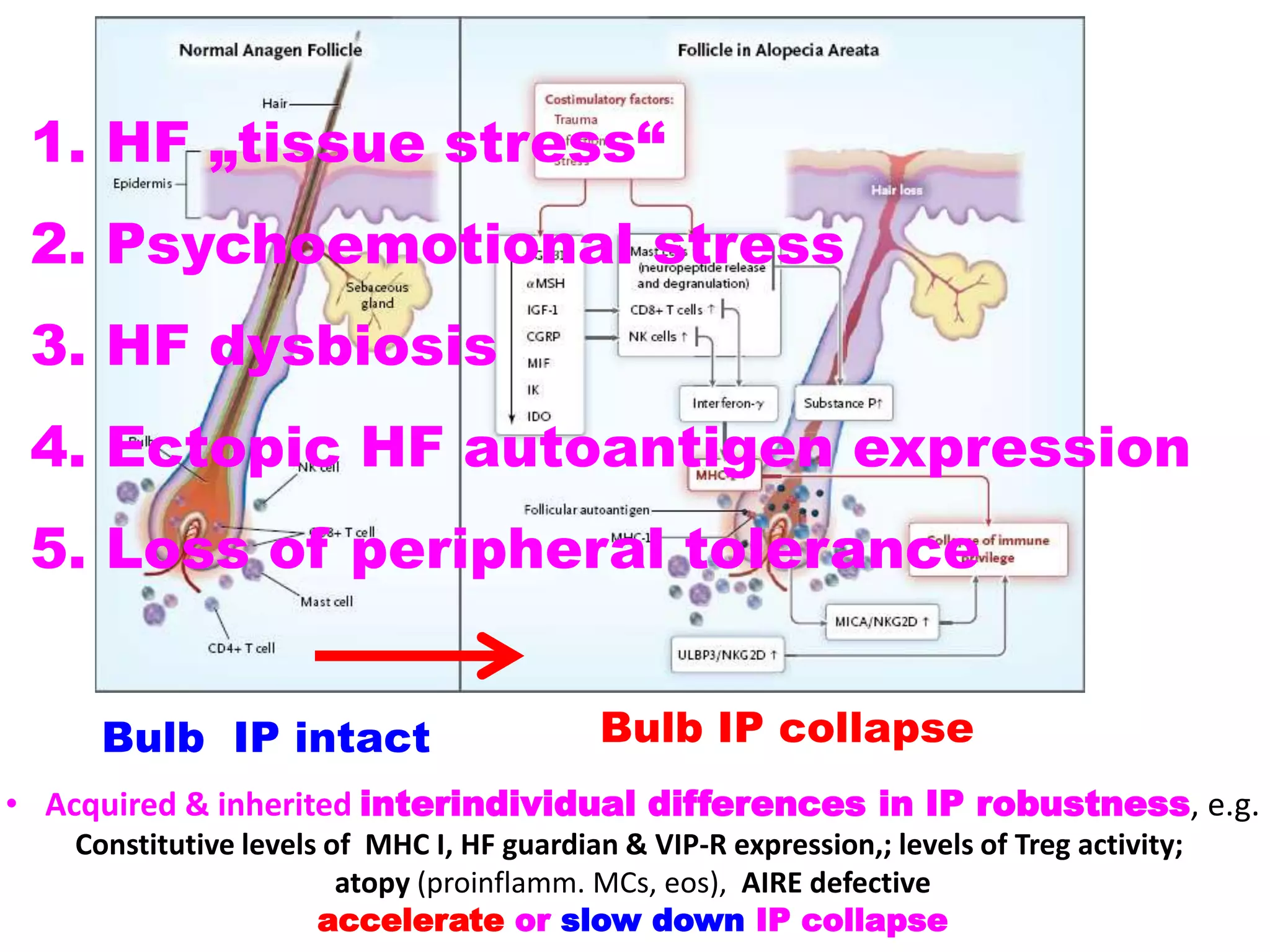 Alopecia Areata: Autoimmune Disease or Hair Follicle Response Pattern ...