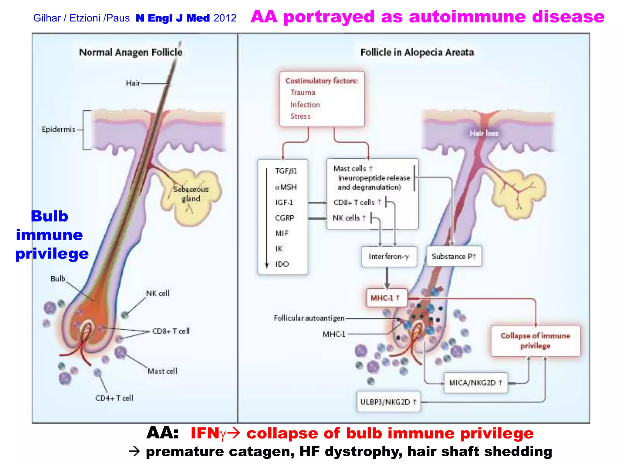 Alopecia Areata: Autoimmune Disease or Hair Follicle Response Pattern ...