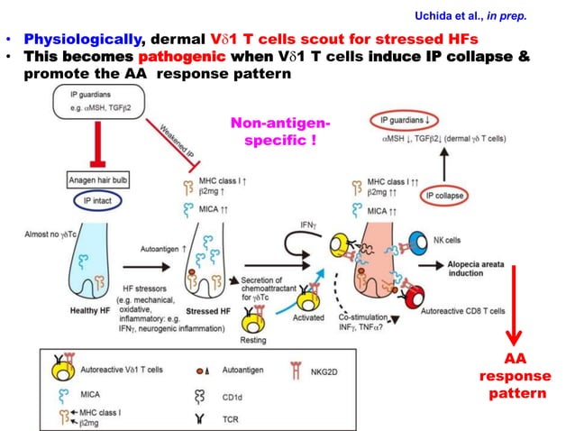 Alopecia Areata: Autoimmune Disease or Hair Follicle Response Pattern ...