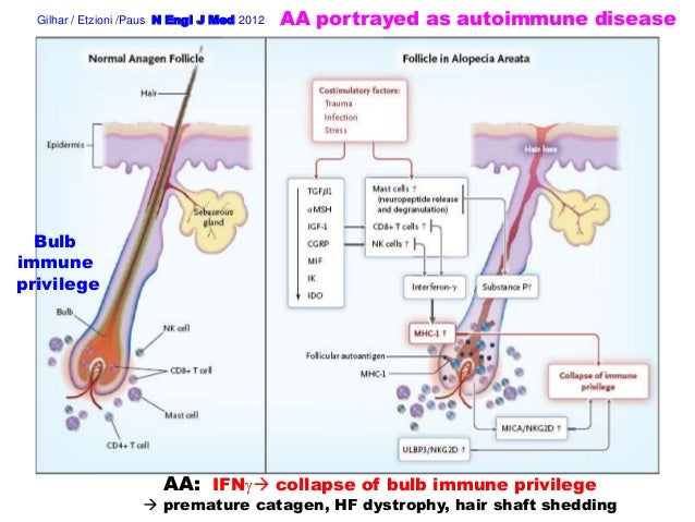 Alopecia Areata Autoimmune Disease Or Hair Follicle Response Pattern