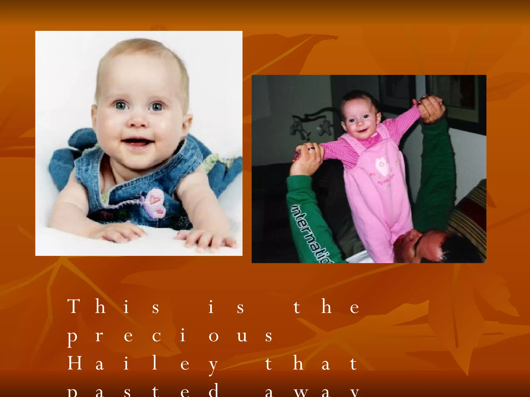 Alpers Syndrome!! | PPT