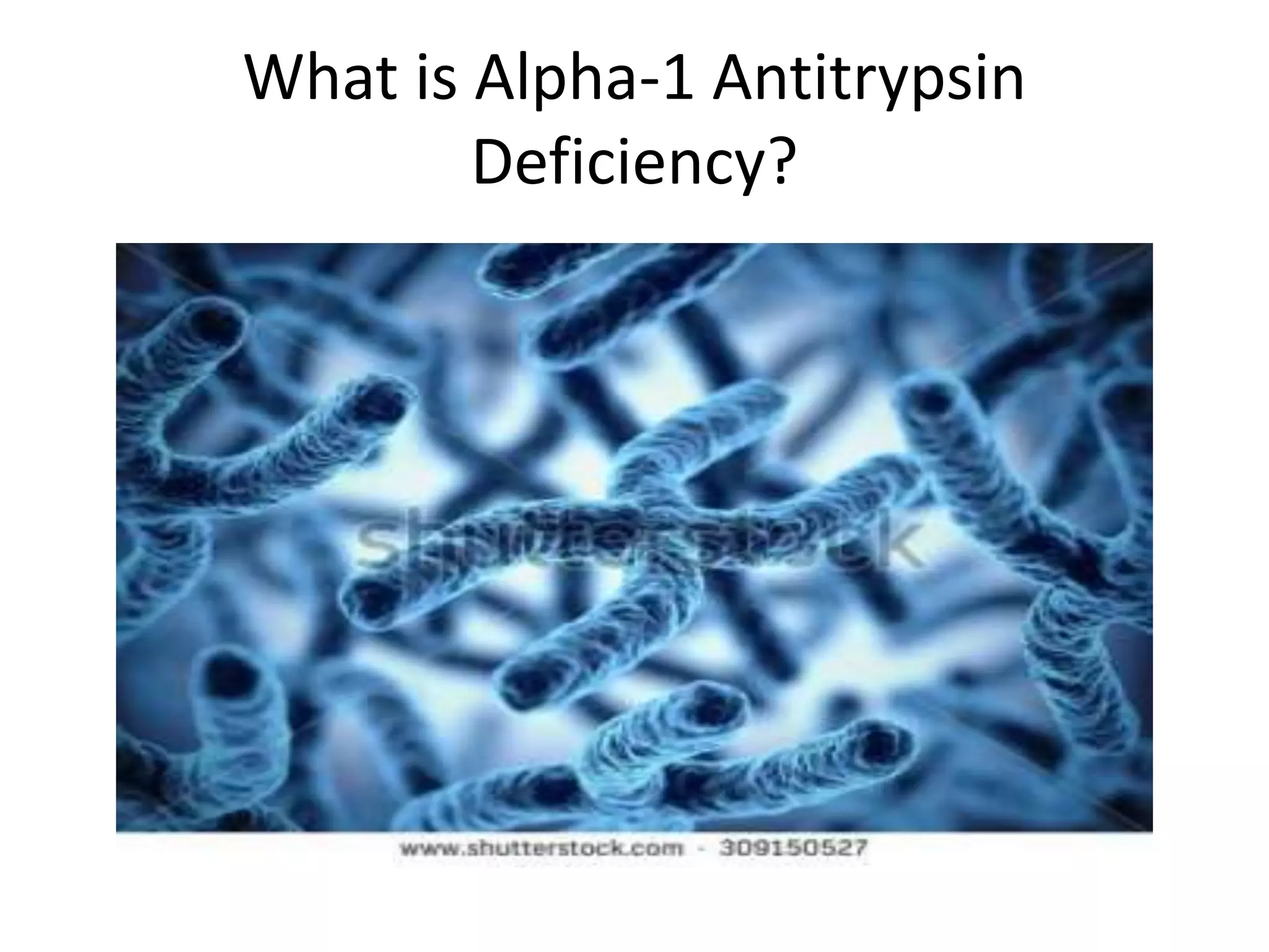 Alpha 1 antitrypsin deficiency | PPTX