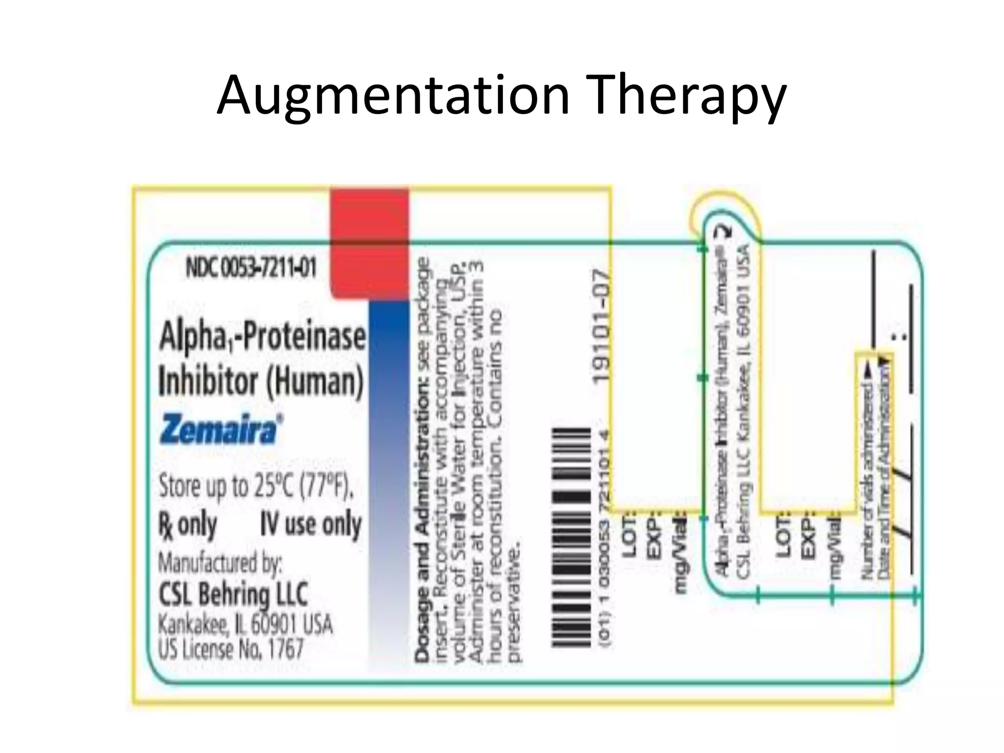 Alpha 1 antitrypsin deficiency | PPTX