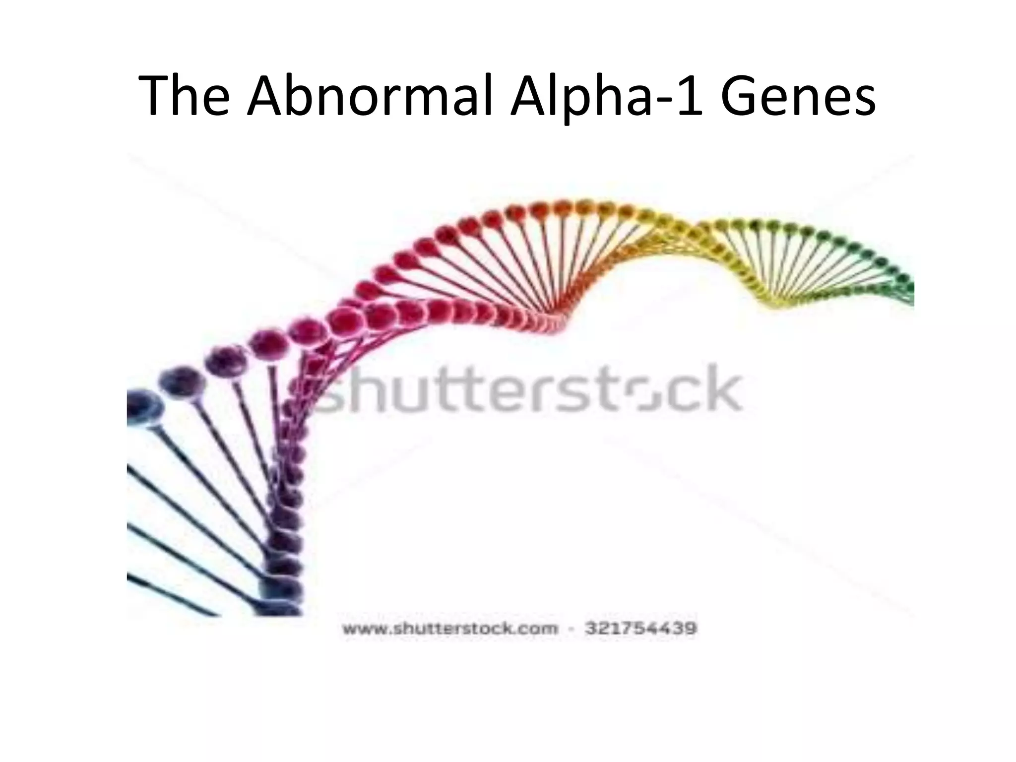 Alpha 1 antitrypsin deficiency | PPTX
