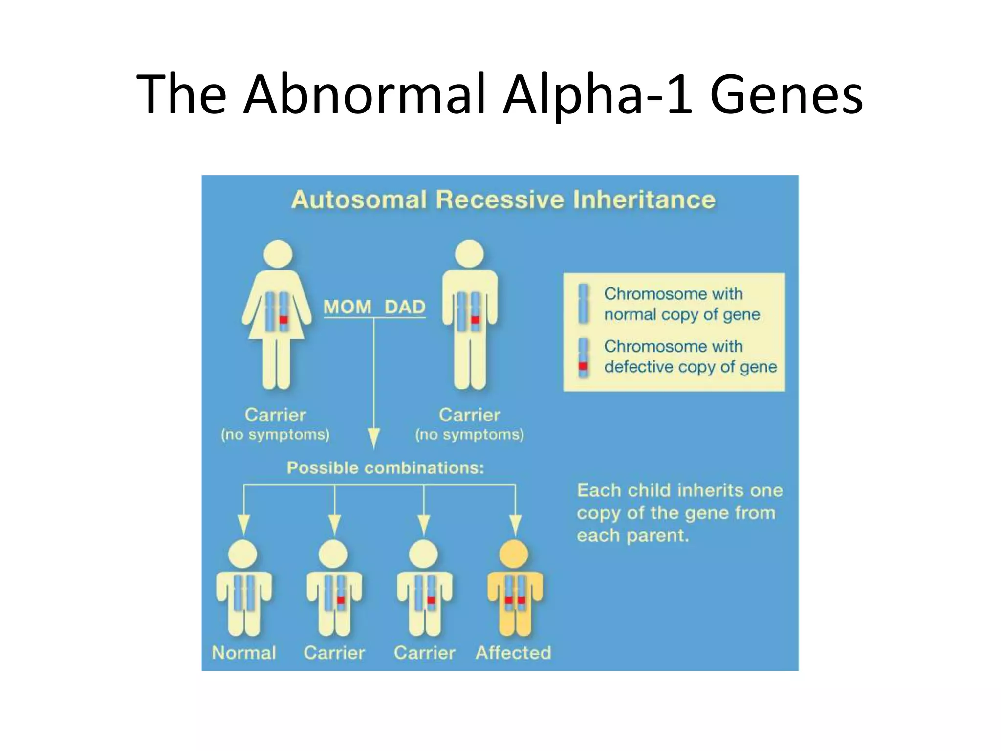 Alpha 1 antitrypsin deficiency | PPTX