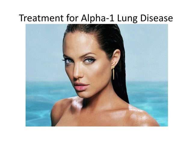 Alpha 1 antitrypsin deficiency | PPTX