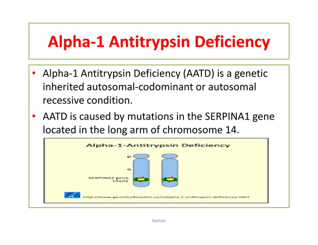 Alpha 1 antitrypsin deficiency: Jimcale M Xamari | PPT