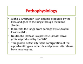 Alpha 1 antitrypsin deficiency: Jimcale M Xamari | PPT
