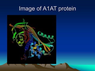 Alpha 1 Antitrypsis Deficiency.ppt