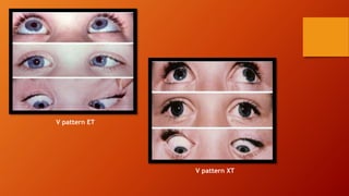 Alphabet patterns | PPT